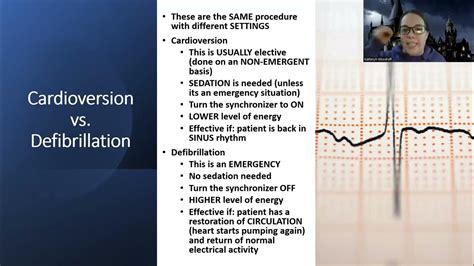 Adult Medsurg Dysrhythmia New Lecture Defibrillation Vs Cardioversion Youtube