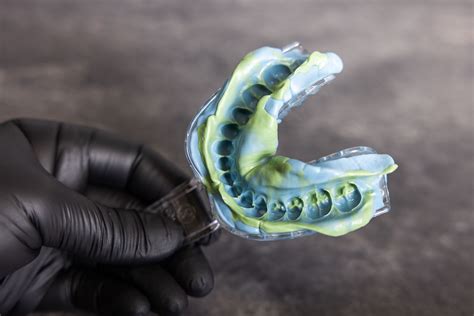 Mastering Dental Impressions Material Types And 10 Tips For Success