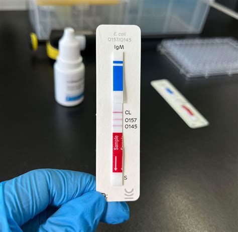 Chemstrip E Coli O O Chemtest