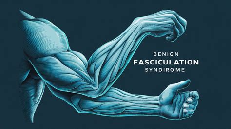 Congenital Deformity Added A New Photo Congenital Deformity