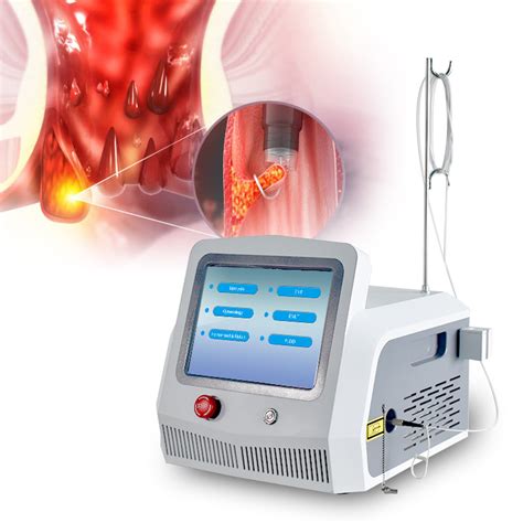 Best Laser Treatment Hemorrhoids Diode Medical Laser Surgery With 980