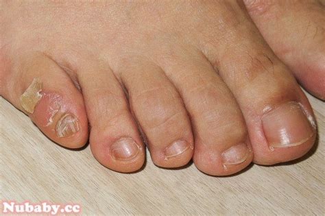 腳部深層精油保養 解決跳舞的厚繭 妮寶貝 指甲矯正光療凝膠精油產品