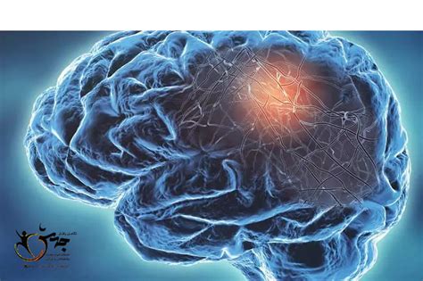 اختلال سیستم عصبی علائم، علل و درمان مرکز توانبخشی جهش