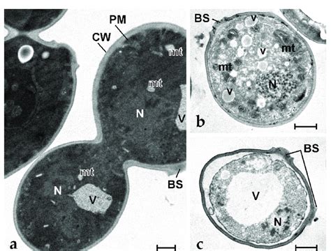 Transmission Electron Micrographs Of S Cerevisiae Cells A Control