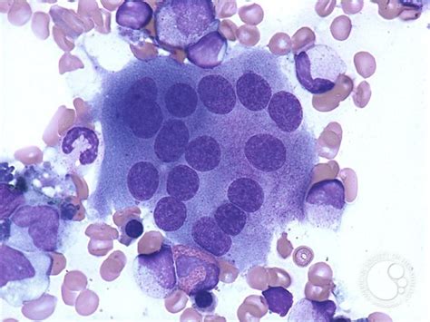 破骨细胞培养及相关细胞因子 知乎