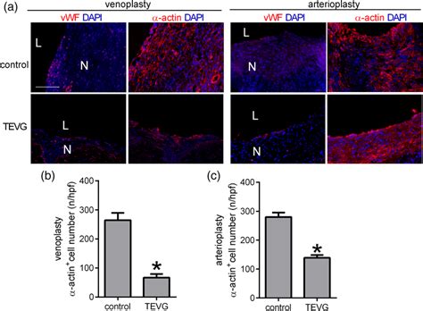 Tevg Patches Decrease Smooth Muscle Cell Accumulation A