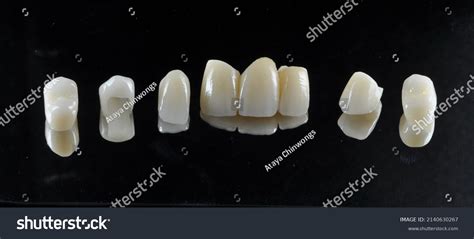 Zirconium Bridge
