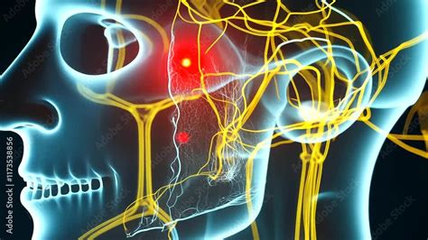 A Close Up Anatomical Diagram Of The Human Face Showing The Trigeminal Nerve Pathways In Yellow