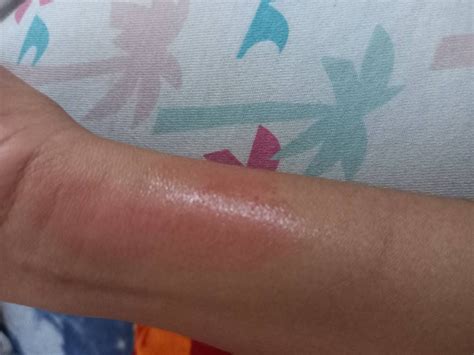 Dot And Key Barrier Repair Ceramide And Peptide Lip Balm Spf 50 Pa