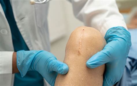 Amy Sisson Bsn On Linkedin Performing Total Joint Surgeries
