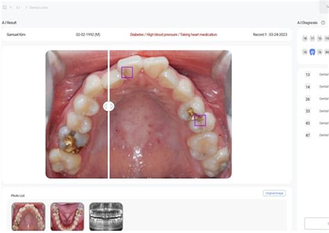 Do Computer Vision Ai Machine Learning Deep Learning Ocr And Opencv Projects By