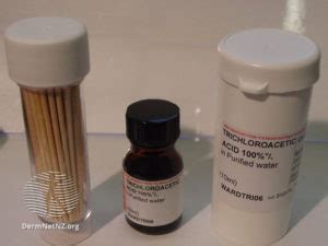 TCA Cross Treatments Ageless Living Cold Lake