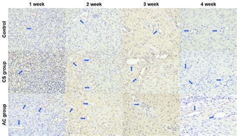 Immunohistochemical Staining Of Cd31 In Each Wound Group Â200