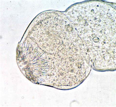 Echinococcus Serology