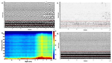 a the raw lfp data of a representative subject while the electrode