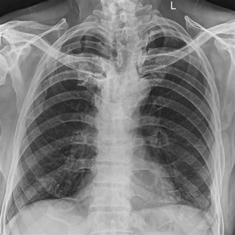 Prognosys Prognosis 2fc Fixed X Ray At ₹ 980000piece In Lucknow Id