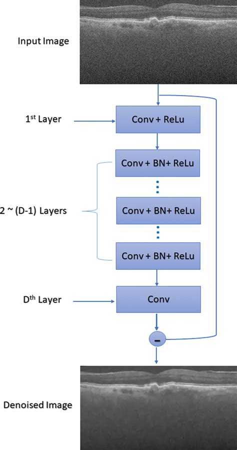 Proposed Network Architecture For Speckle Denoising Residual Cnn Having