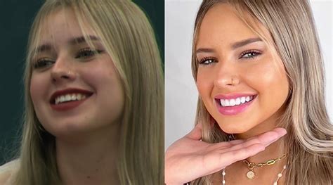 Coti Romero Reveló Qué Retoques Se Hizo En La Cara Con Un Fuerte