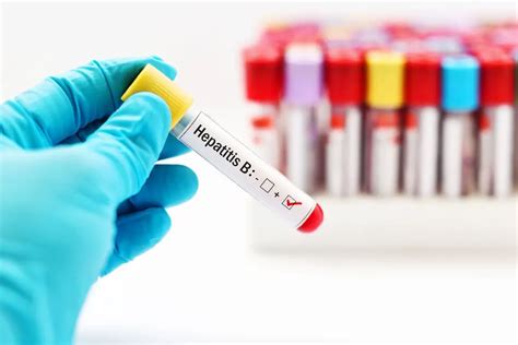 Sti And Std Testing Procedure Information For Men And Women