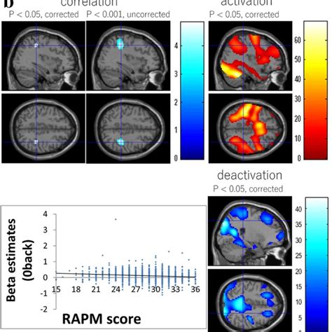 Associations Between Regional Neural Activity During A Simple Cognitive