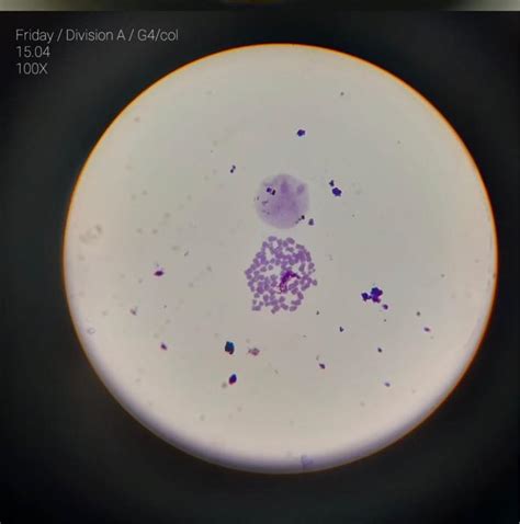 Solved This Is Mcf 7 Breast Cell Line Under Microscope After
