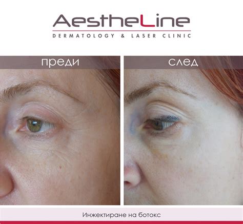 Дерматологична и естетична клиника Aestheline