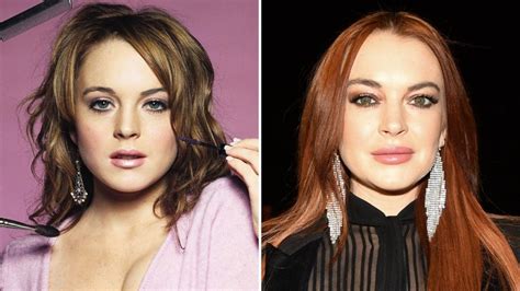 Lindsay Lohan Plastic Surgery Before And After