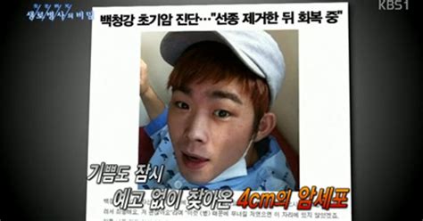 직장암 투병 백청강 근황 선명한 수술자국 안타까워