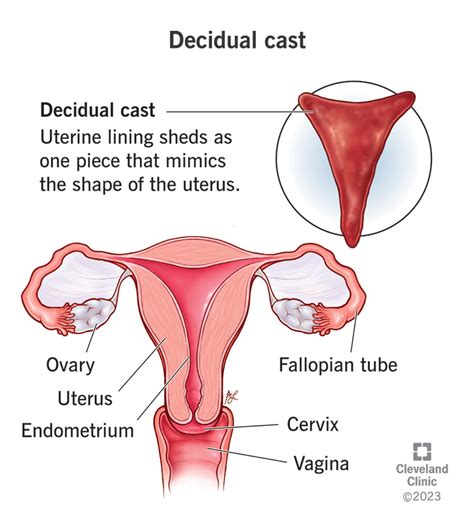 Uterine Lining Shedding All At Once