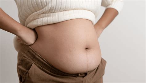 Apron Belly What It Is Why It Happens And How To Reduce It