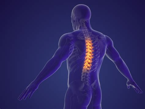 Omurga Kırıkları Ve Kaymaları Tedavileri Op Dr Fecri Çiftlik