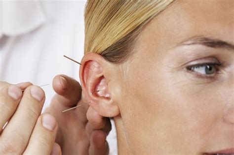 Acupuncture For Weight Loss Definition Sensitive Points And Ear