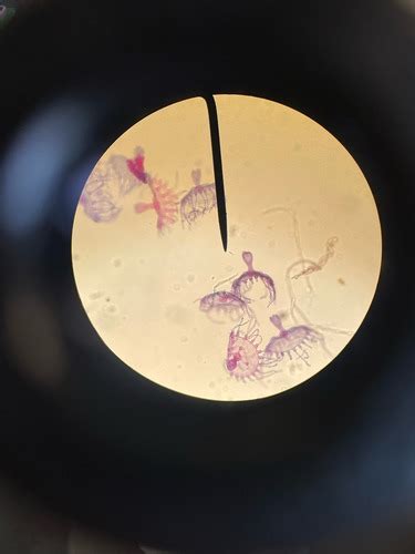 Bio100b Invertebrates I Lab Quiz Flashcards Quizlet
