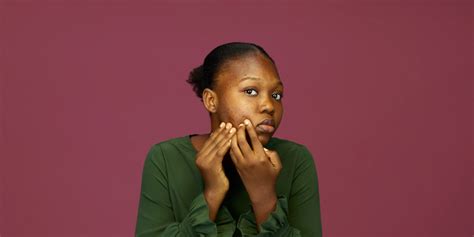 Everything You Need To Know About Hyperpigmentation In Ghana Berry Health