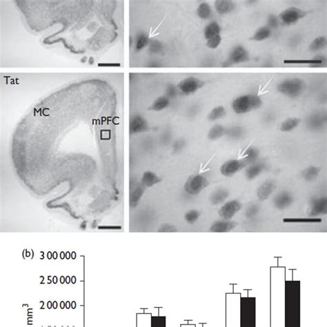 Transactivator Of Transcription Tat Did Not Alter The Number Of