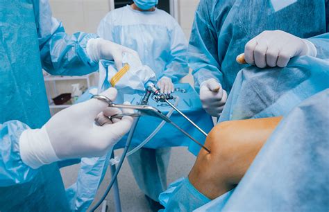 Dr Nic Rogers Arthroscopic Knee Surgery