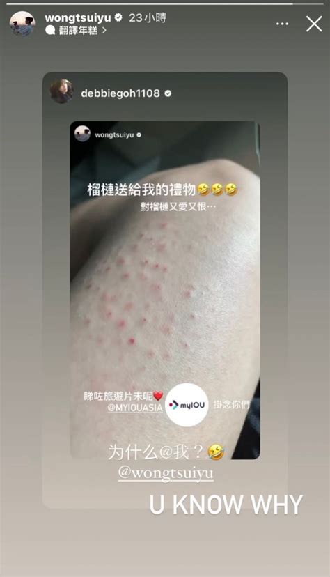 正妹主持人慘遭「榴槤砸中」！美腿驚見數顆「鮮紅洞口」 Beanfun