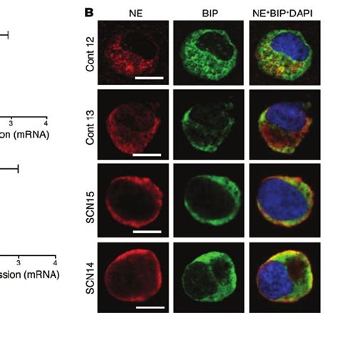 Cellular Consequences Of Elane Mutation Correction Of Elane Mutation