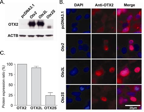 Protein Expression And Cellular Localization Of Otx2 Variants A