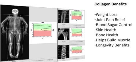 Collagen For Bones Benefits Types Sources Timing Dosage And More