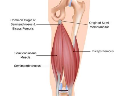 Proximal Hamstring Repair Hip Surgeon Los Angeles Orange County Ca