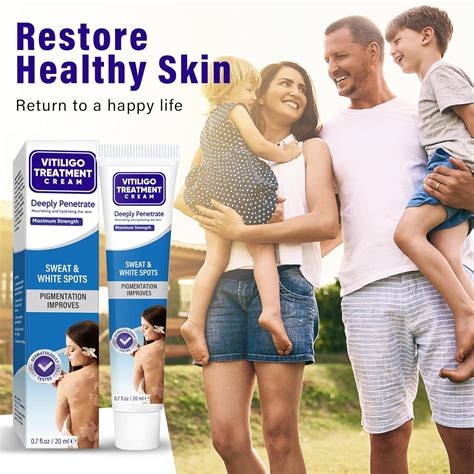 Plazala Crema De Vitiligo Tratamiento Natural Eficaz Para El Vitíligo