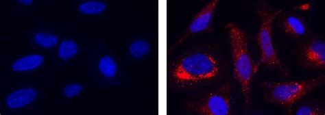 活性氧 Cell Meter 线粒体羟基自由基检测试剂盒 西安百萤生物科技有限公司