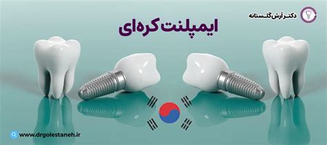 ایمپلنت کره ای لیست انواع برندها معایب و مزایا دکتر آرش گلستانه