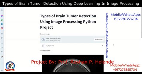 Types Of Brain Tumor Detection Using Deep Learning Brain Tumor Types Classification Using