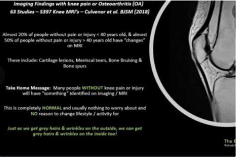 Common Knee Problems And How We Can Help Blue Align Chiropractic