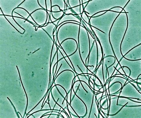 Chloroflexi Class Alchetron The Free Social Encyclopedia