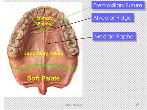 Hard And Soft Palate Pptx