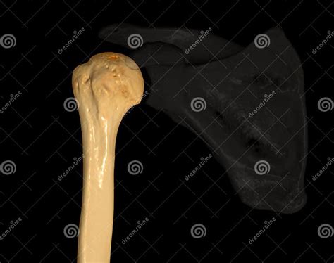 Ct Shoulder 3d Stock Illustration Illustration Of Elbow 257208889