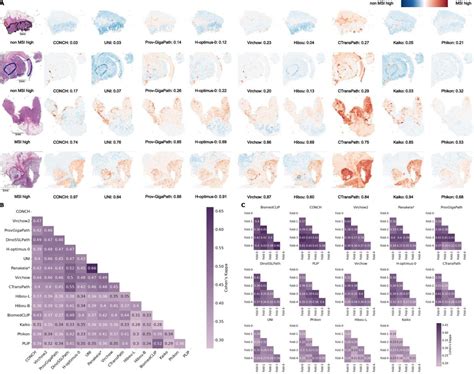 Figure 4 From Benchmarking Foundation Models As Feature Extractors For Weakly Supervised